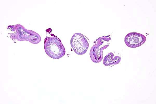 Read-Only Case Details Reviewed: Jan 2010