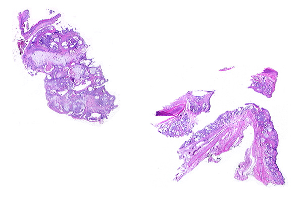 Read-Only Case Details Reviewed: Oct 2010