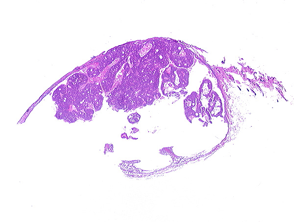 Read-Only Case Details Reviewed: Oct 2010