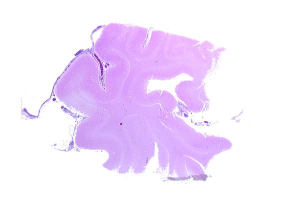 Read-Only Case Details Reviewed: Feb 2008