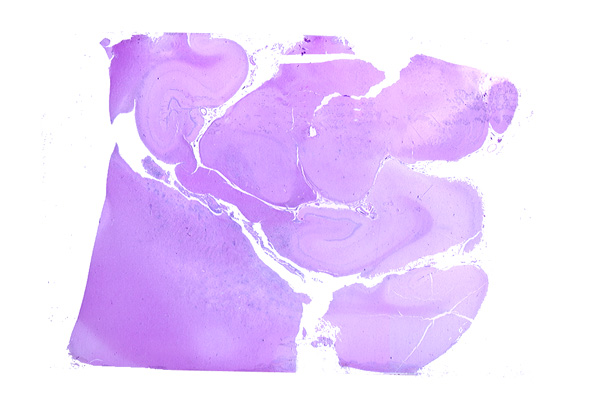 Read-Only Case Details Reviewed: Feb 2008