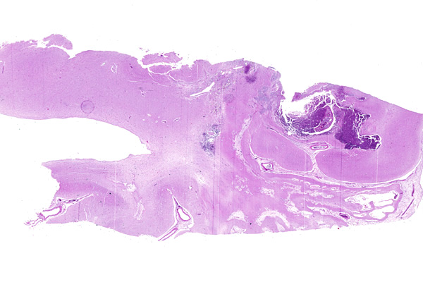 Read-Only Case Details Reviewed: Apr 2008