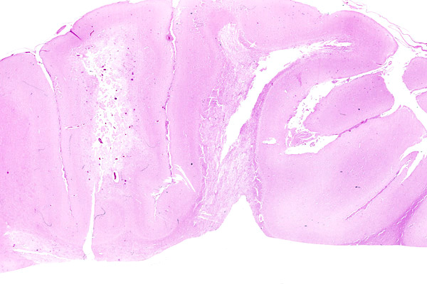 Read-Only Case Details Reviewed: Apr 2008