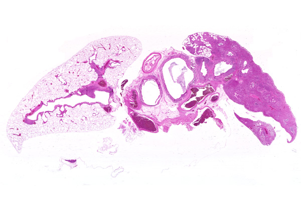 Read-Only Case Details Reviewed: Sep 2008