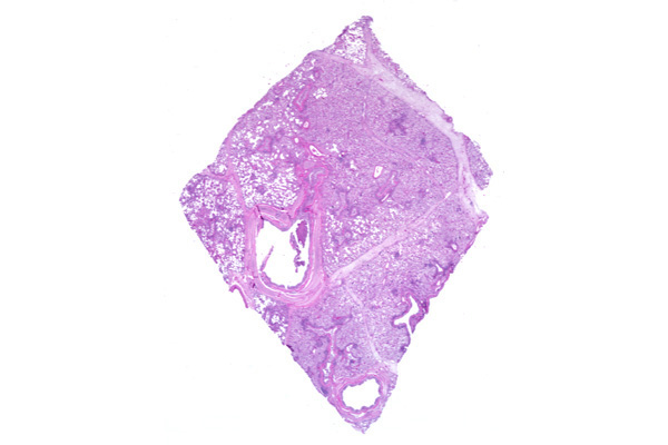 Read-Only Case Details Reviewed: Sep 2008