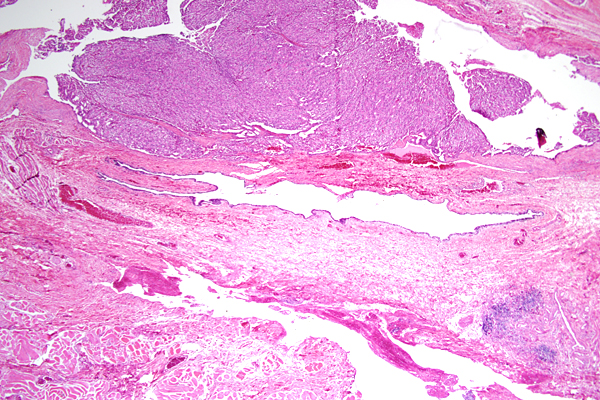 sn05ba02.jpg