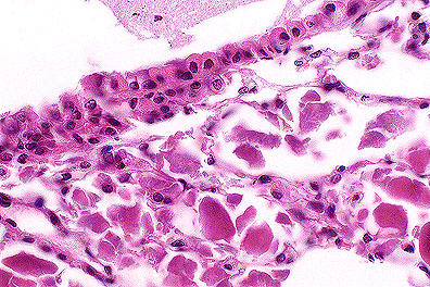 Alveolar Macrophage Histology