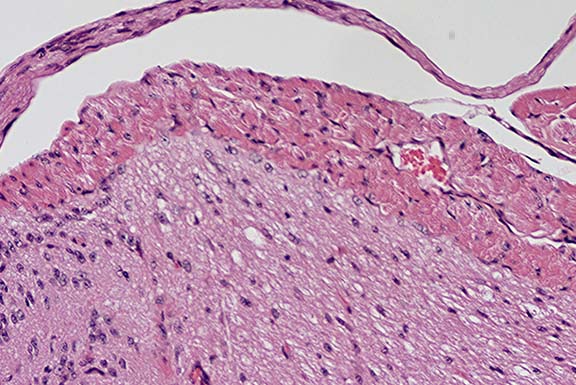 Spinal Cord Meninges Histology