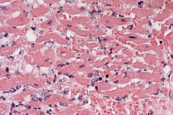 Clostridium chauvoei